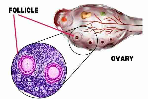 Exploring the Link Between Ovulation Pain and Infertility